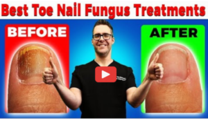 Biblical Cure for Toenail Fungus: Does It Really Work?